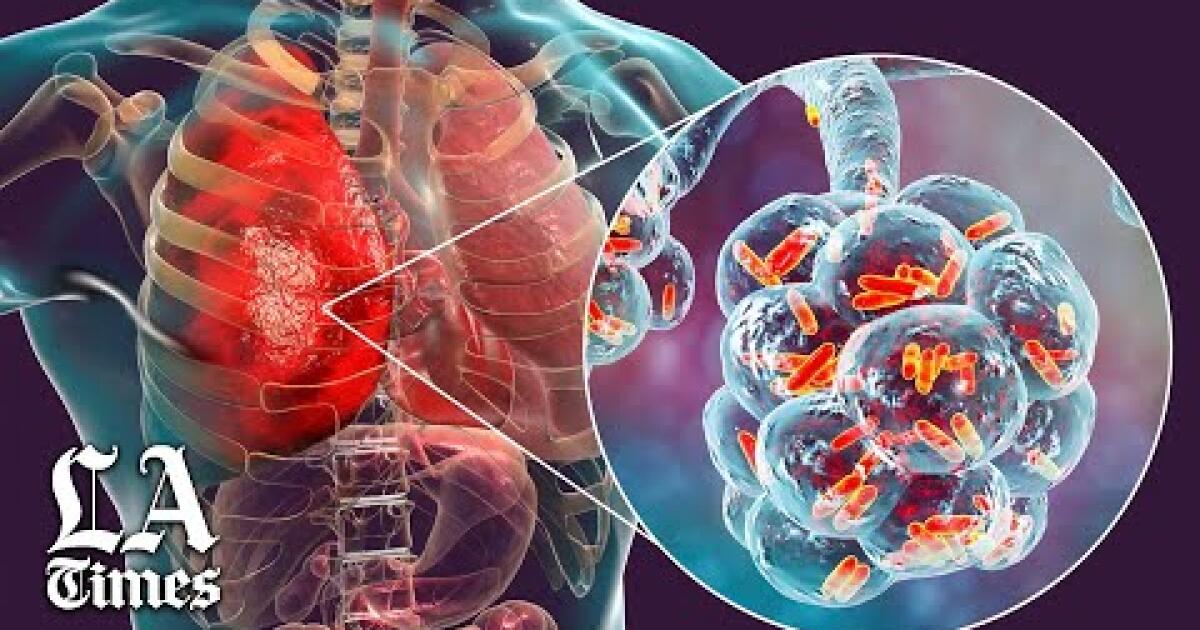 Part 4: The Symptomatic Patient - Los Angeles Times