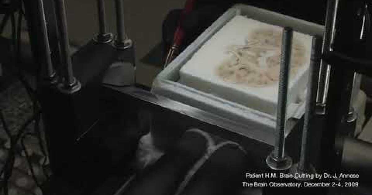 Brain of famous amnesiac "H.M." yields new insights into memory - Los ...